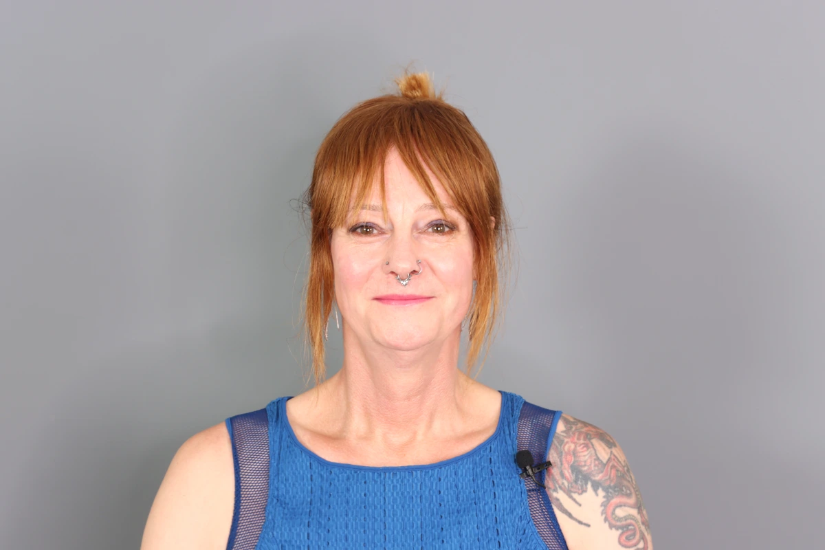 Reflections from the UK: Deena 3-Years After FFS Surgery ...